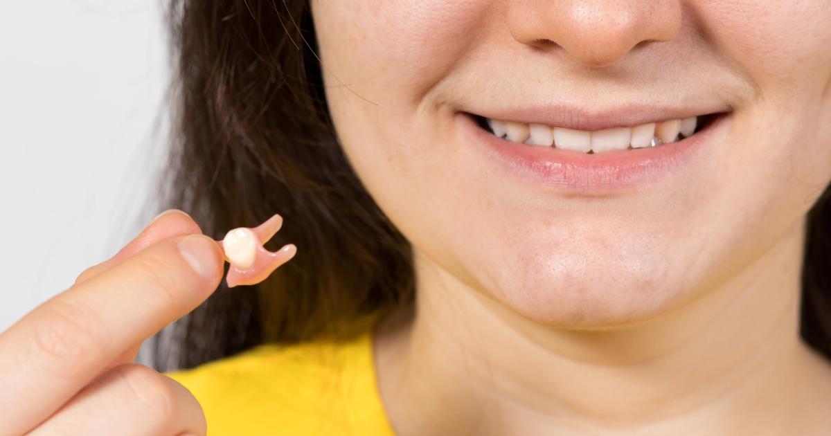 What is a dental flipper? Temporary Missing Tooth Solution | Affordable ...