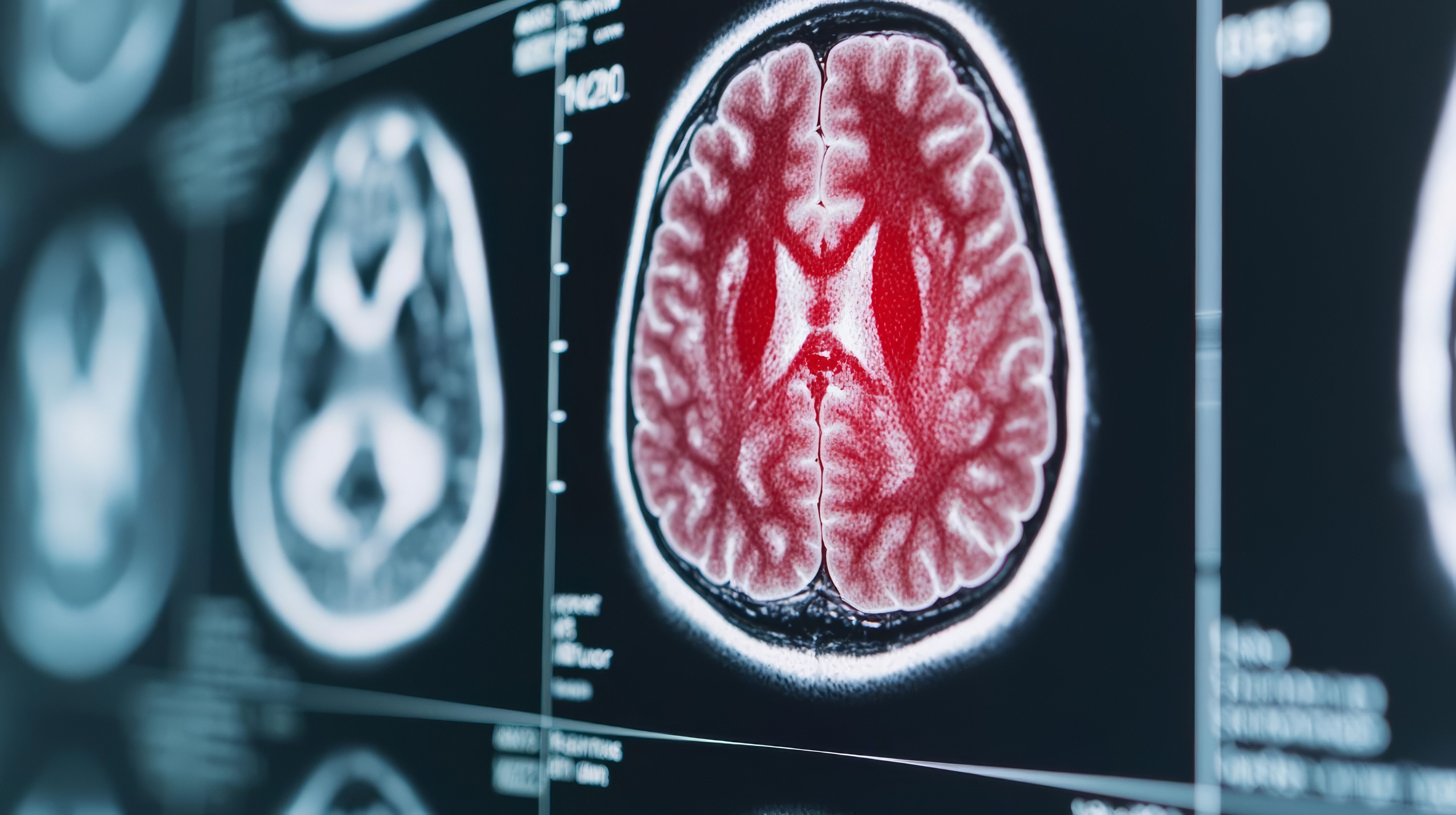 Protecting Patient Data with HIPAA-Compliant Systems at Brain Mapping ...
