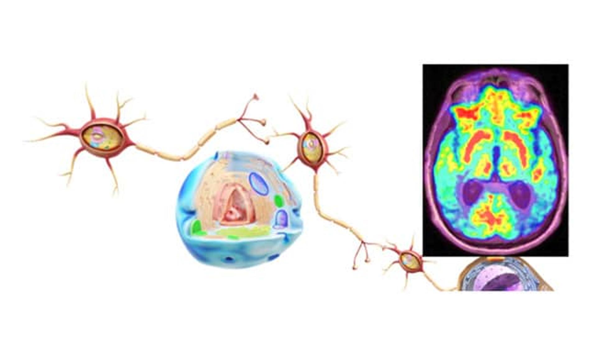PRISM Imaging - Neurodegenerative and Neurocognitive - Insight | Brain ...