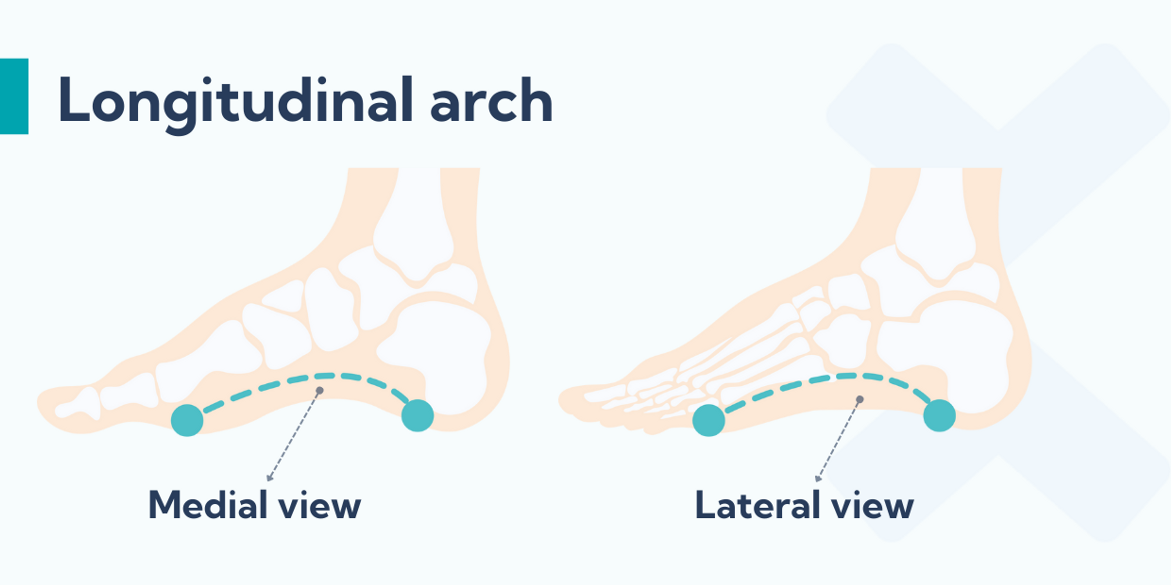 Medial Longitudinal Arch Support