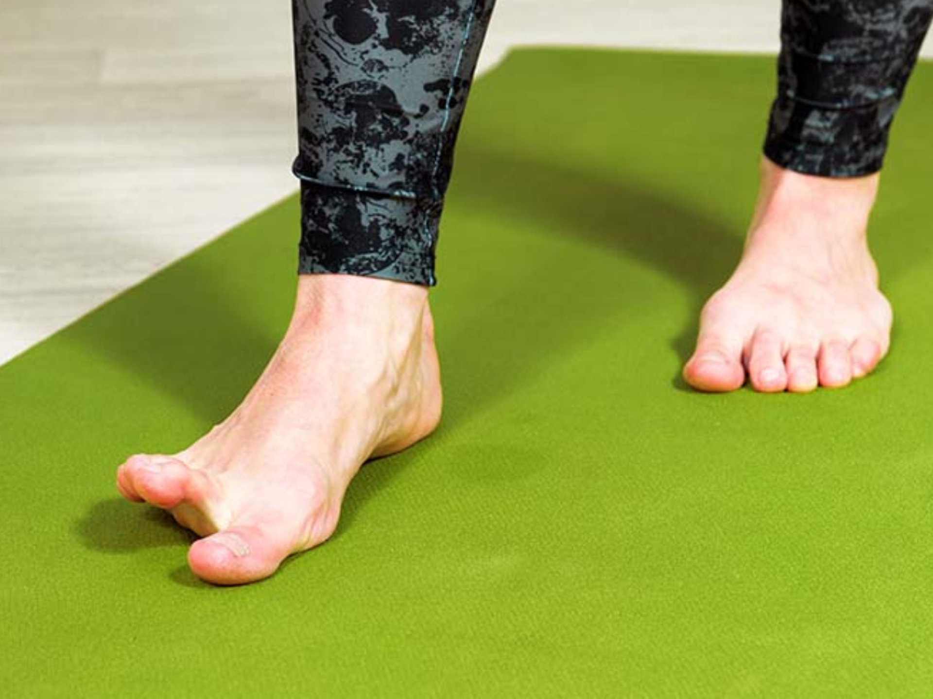 What causes plantar fasciitis to flare up, and what to do about it