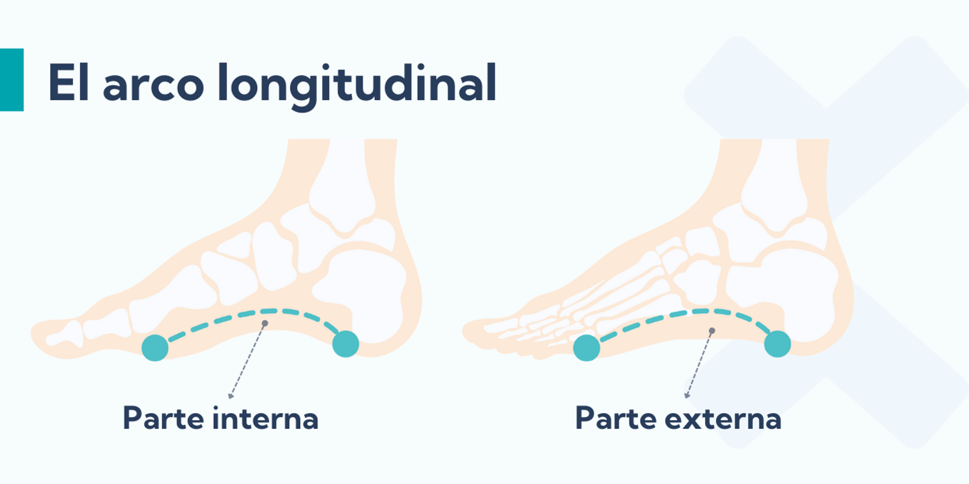 ¿Las plantillas para periostitis tibial pueden ayudar en el tratamiento ...