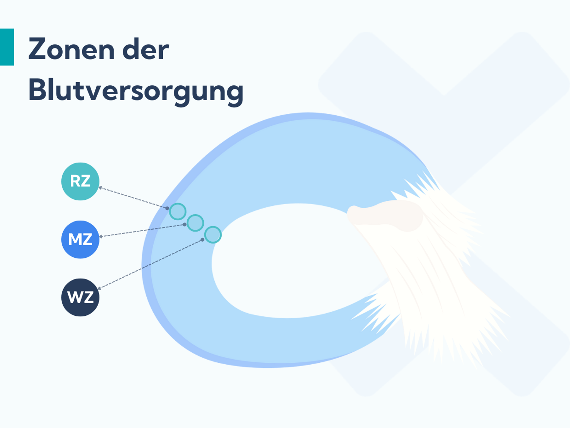 Laufratgeber: Meniskusrisse behandeln