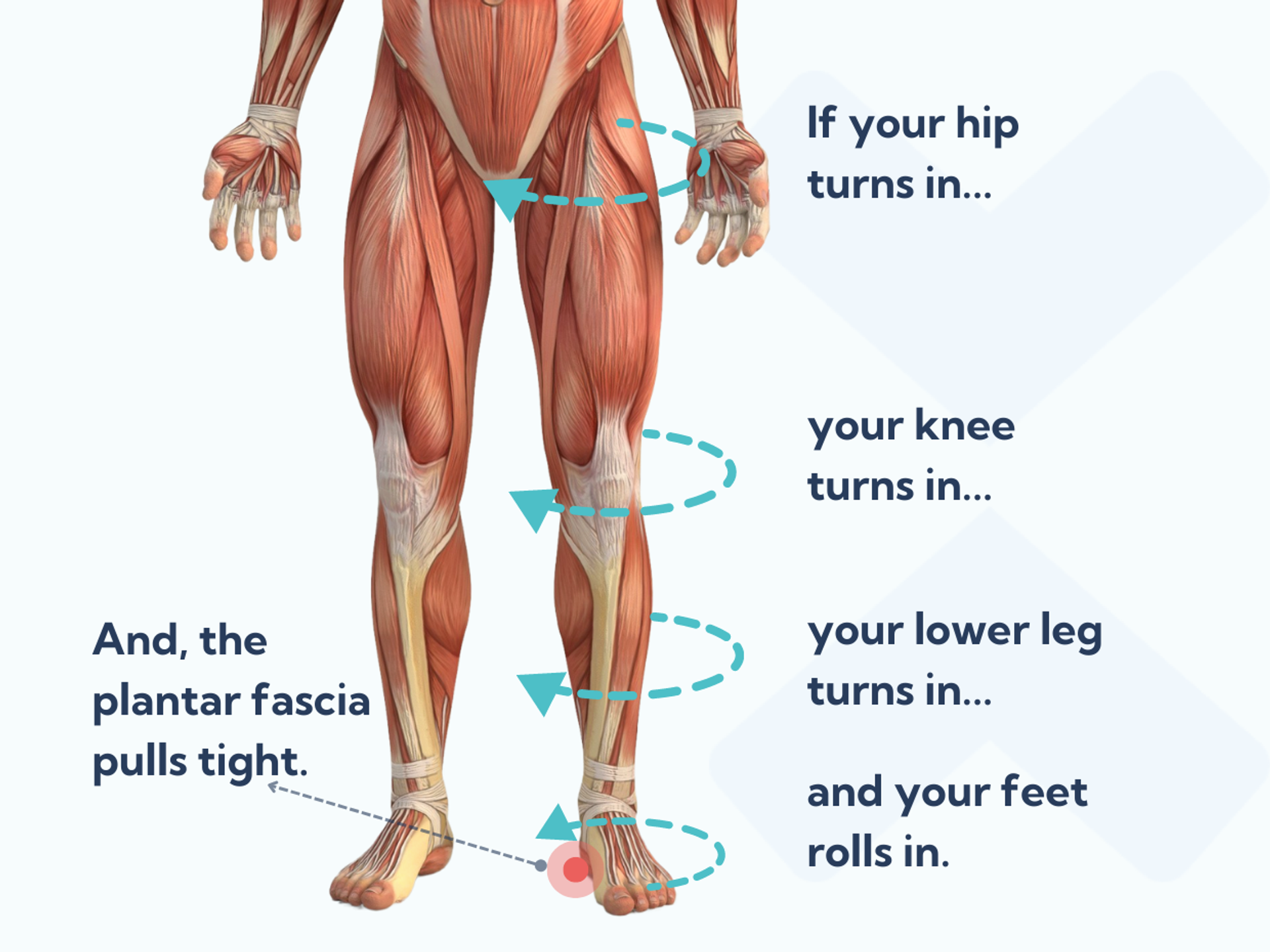 Hip and leg exercises for Plantar Fasciitis: How they can help your ...