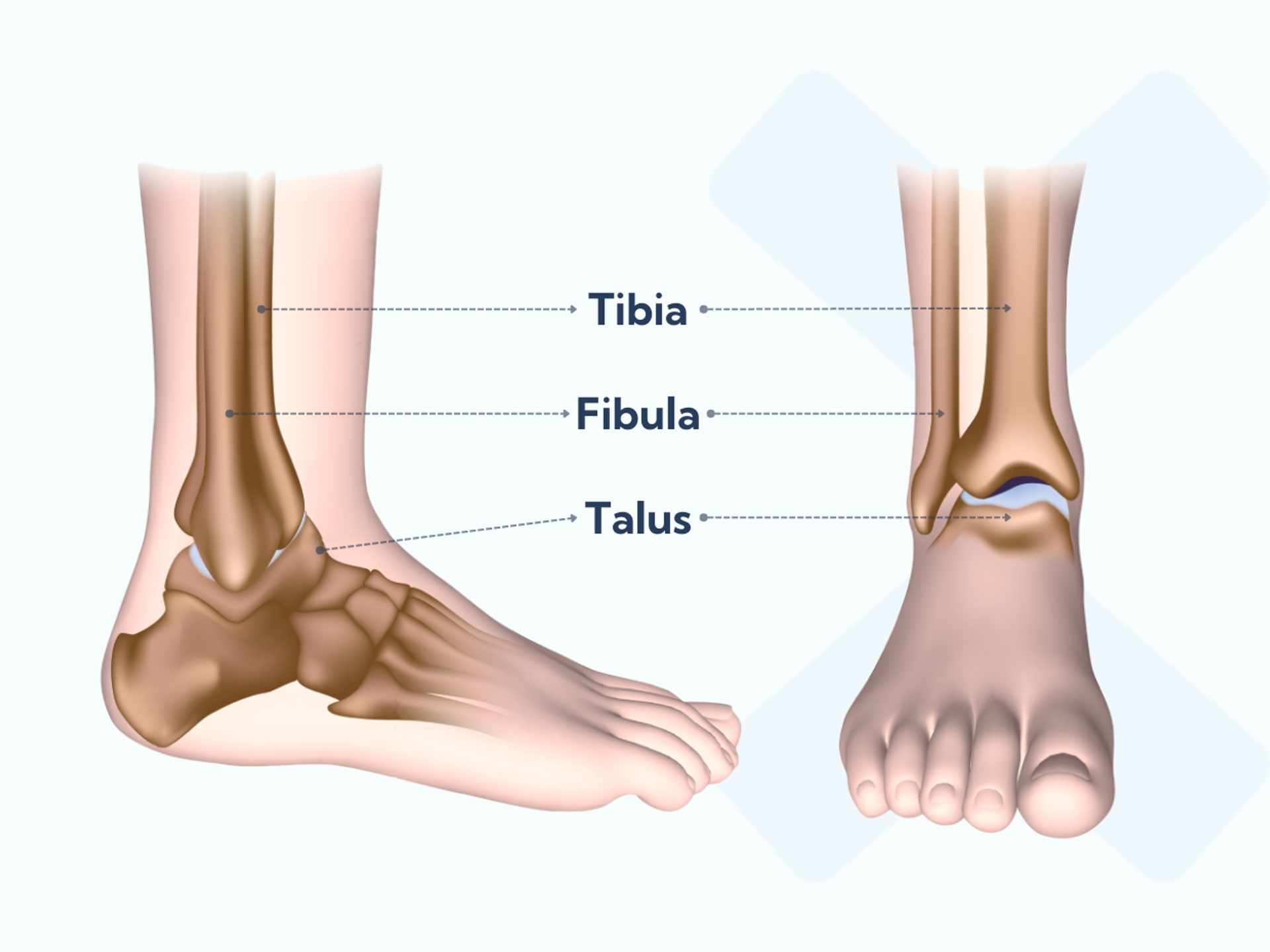Ankle sprains: The types, causes, and best treatments