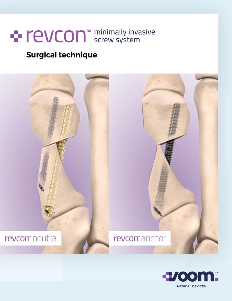 Revcon™ Screw System | Voom™ Medical Devices | Minimally Invasive ...