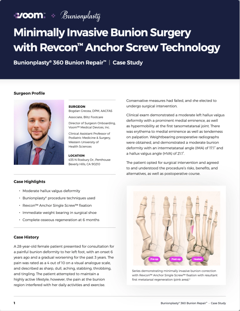 Revcon™ Screw System | Voom™ Medical Devices | Minimally Invasive ...