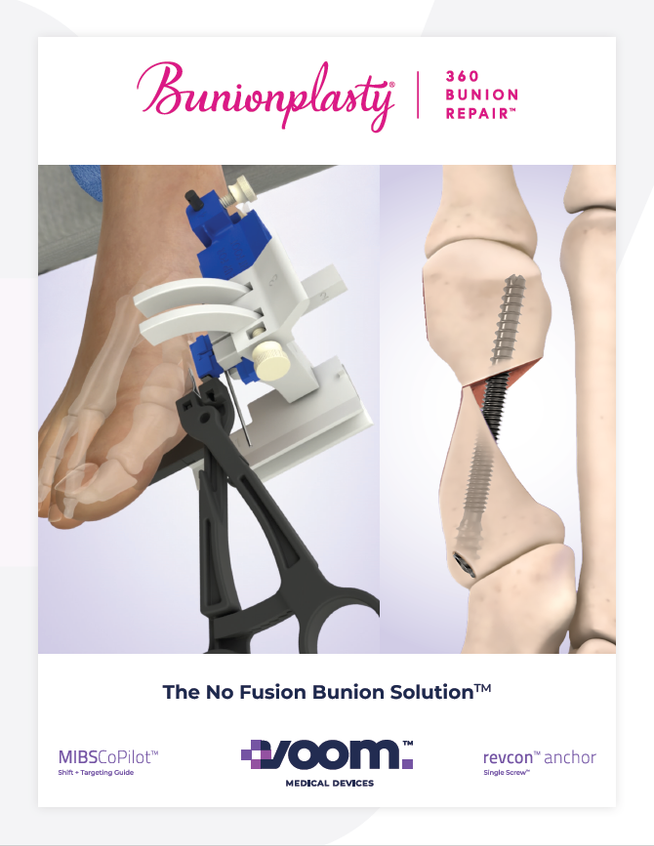 Revcon™ Screw System | Voom™ Medical Devices | Minimally Invasive ...