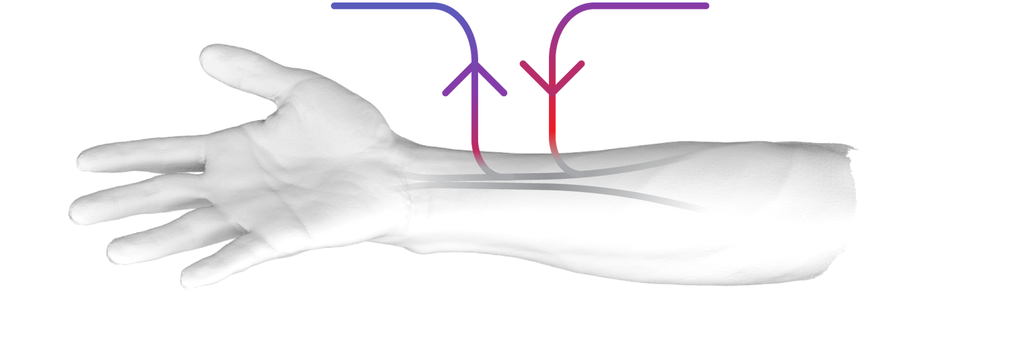 How SelfWrap Works - VenoStent