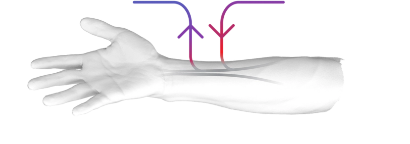 How SelfWrap Works - VenoStent