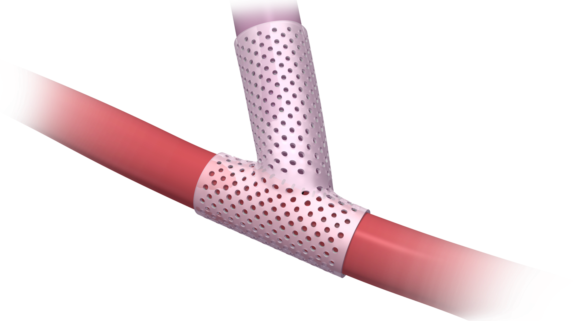 Bioengineered Vascular Support