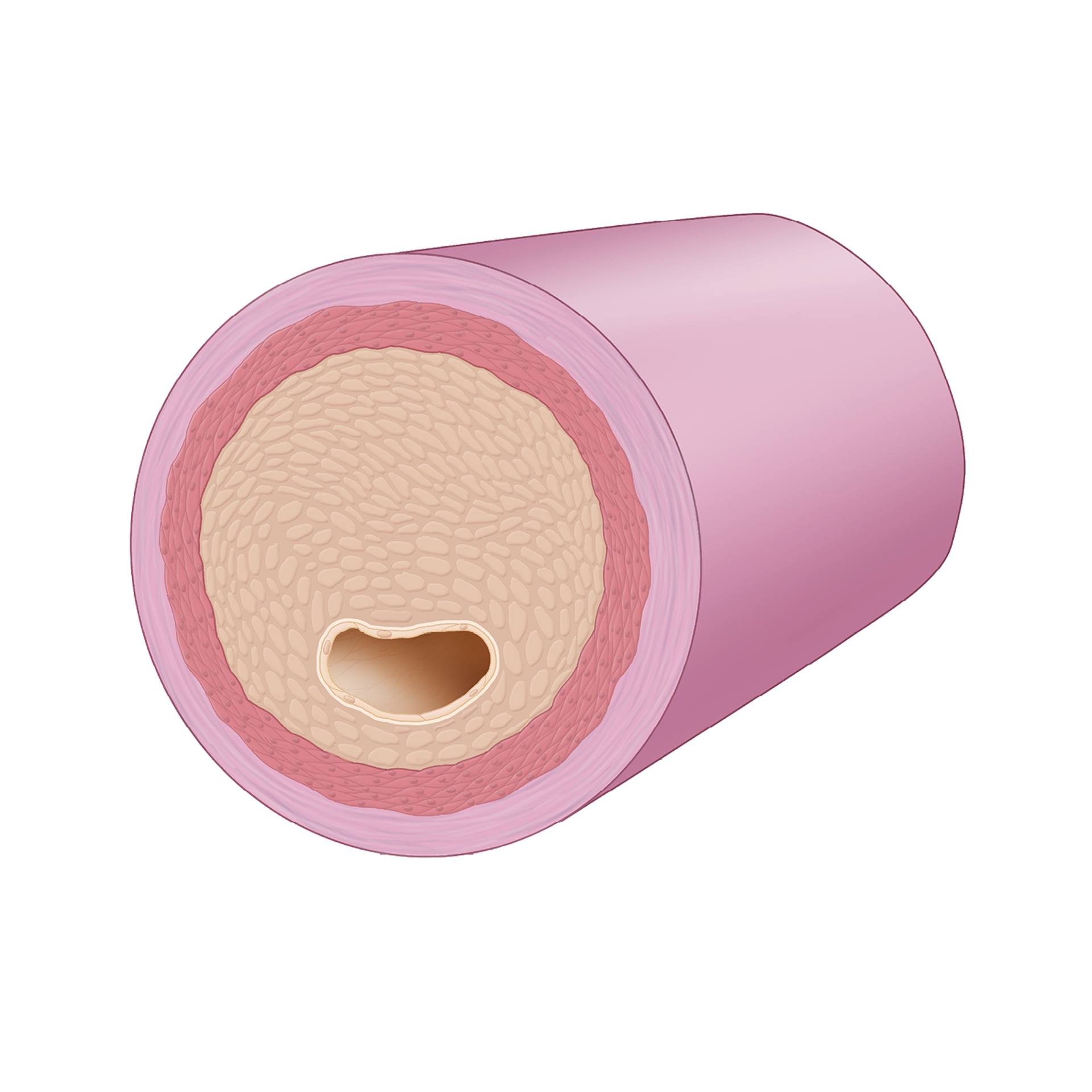 How SelfWrap Works - VenoStent