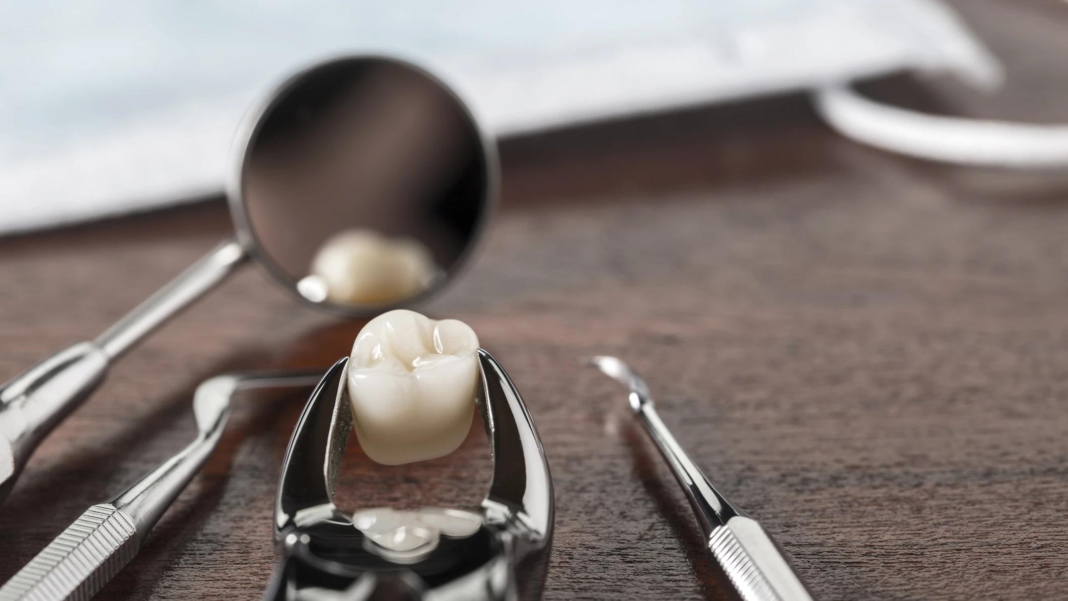 Dental Extraction Cost Comparison: Albania vs the UK vs Poland vs ...