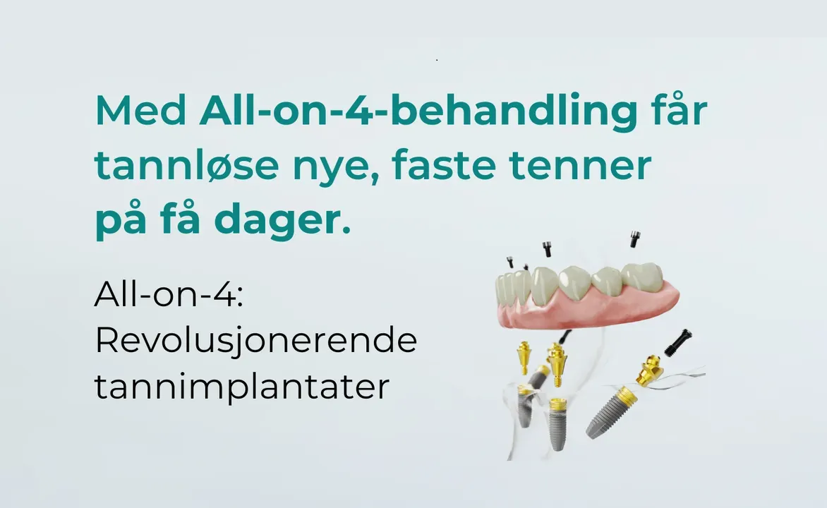 Faste nye tenner kun fire dager etter operasjon – dette er all-on-4