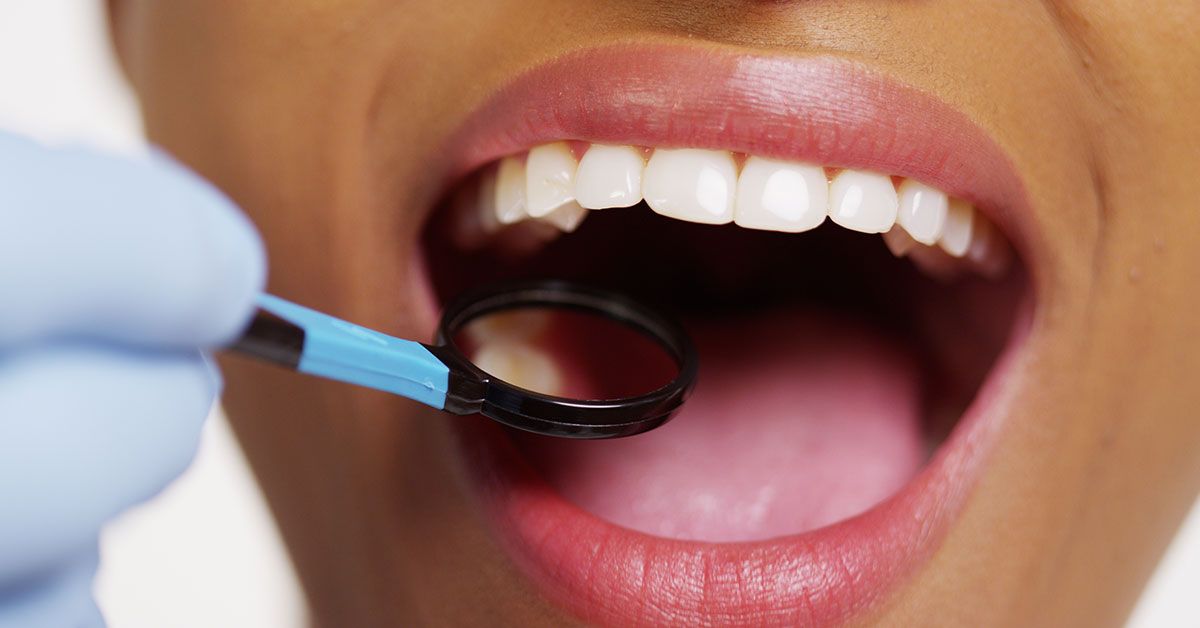 Smile! New Study Reveals Injectable Hydrogel Dental Treatment