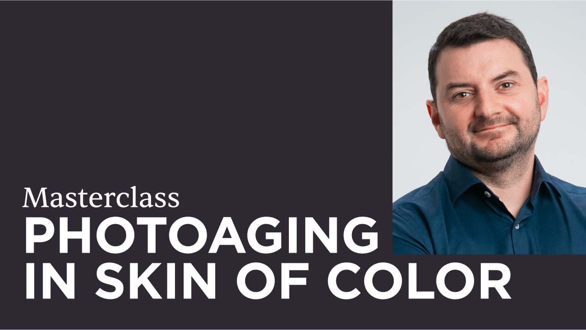 Photoaging in Skin Of Color