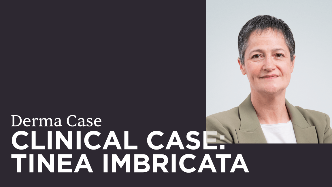 Tinea Imbricata: The Most Curious Dermatophytosis