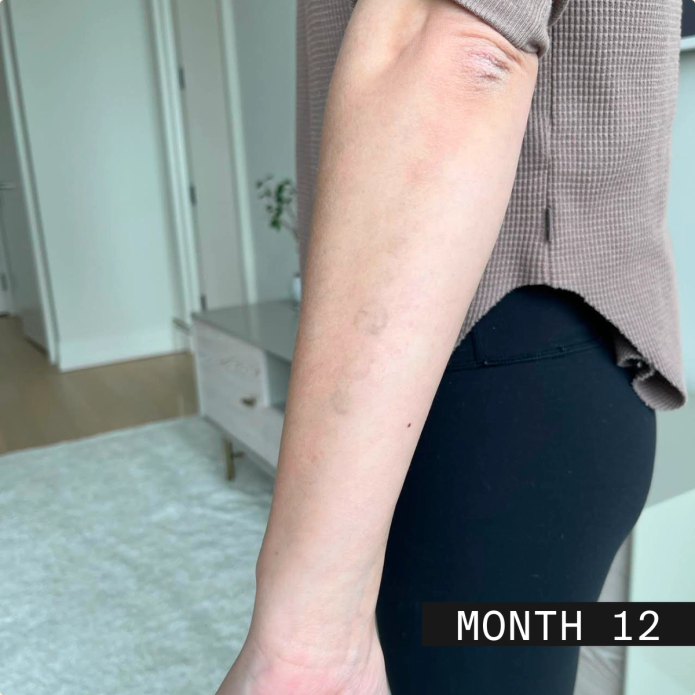 How Ephemeral Ink Works - Ephemeral Tattoo