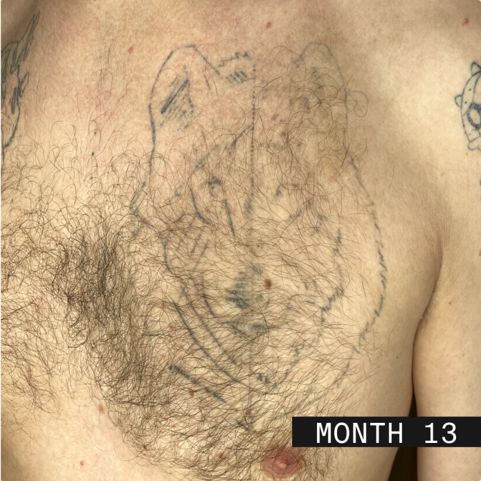 How Ephemeral Ink Works - Ephemeral Tattoo