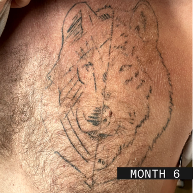 How Ephemeral Ink Works - Ephemeral Tattoo