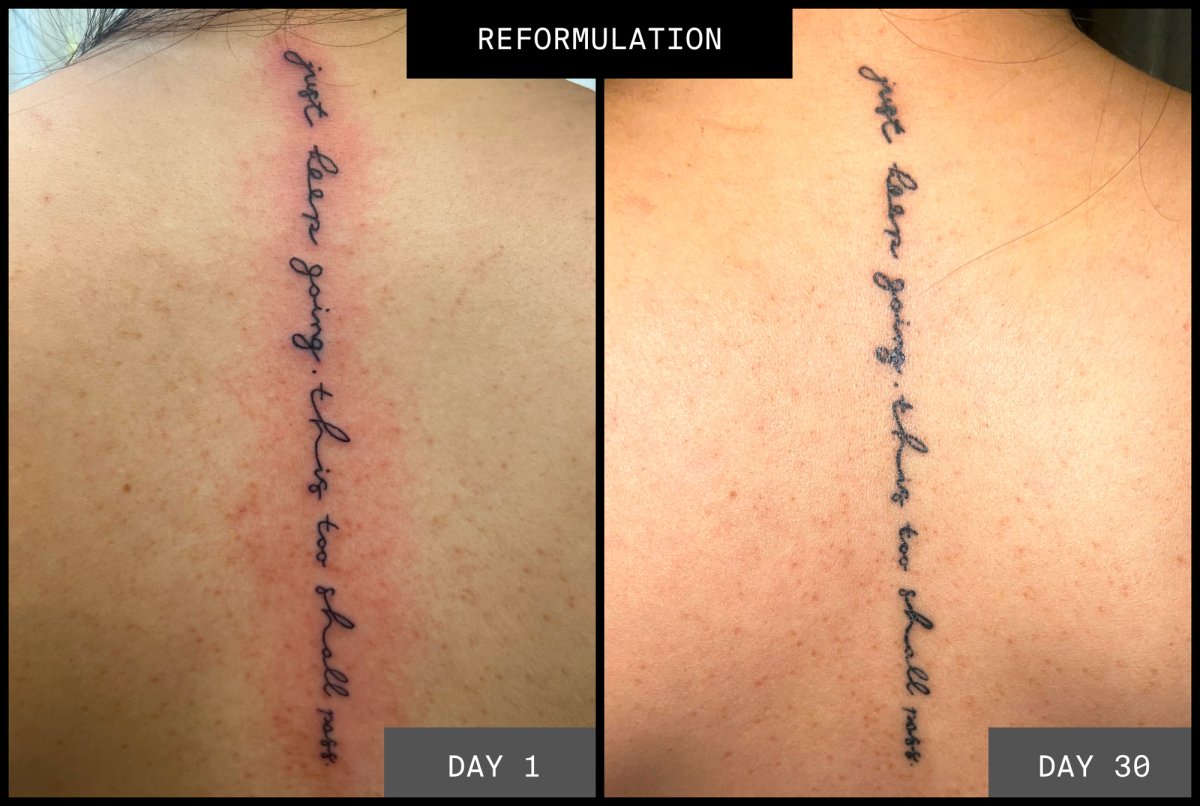 See the Latest Improvements to Ephemeral Ink in 2024 - Ephemeral Tattoo