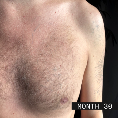 How Ephemeral Ink Works - Ephemeral Tattoo