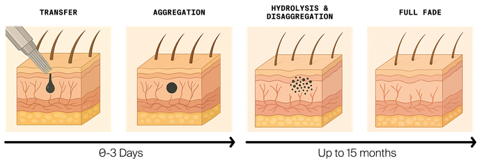 Ephemeral Ink for Radiation Therapy - Ephemeral Tattoo