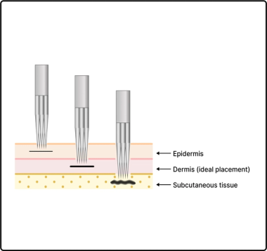 How Ephemeral Ink Works - Ephemeral Tattoo