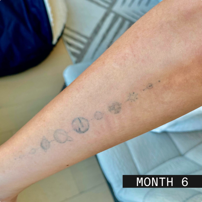 How Ephemeral Ink Works - Ephemeral Tattoo