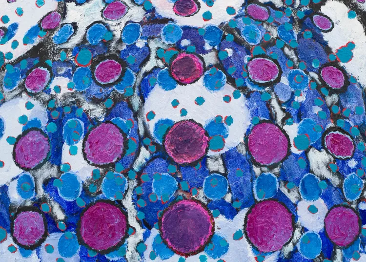 Terry Winters - Modern Art