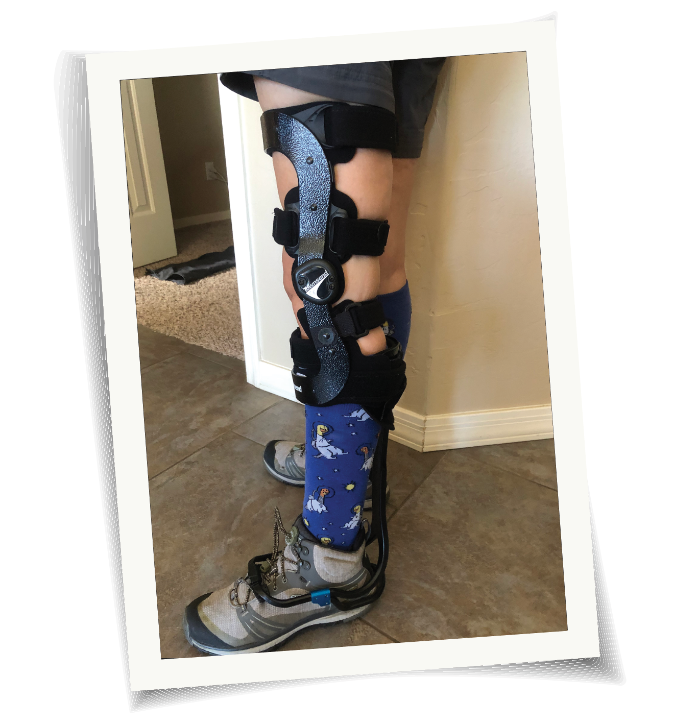Orthotics for MS Walking Difficulties | National MS Society