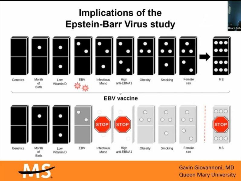 Epstein-Barr Virus in Triggering MS