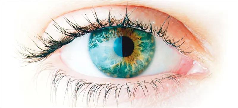 4 Ways to Manage Double Vision | National MS Society