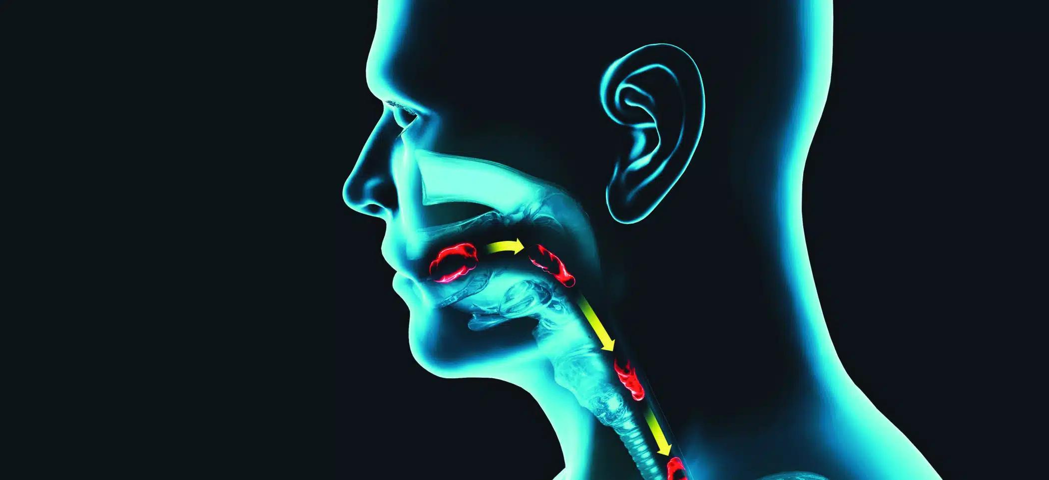 Tips for Handling Dysphagia in MS | National MS Society