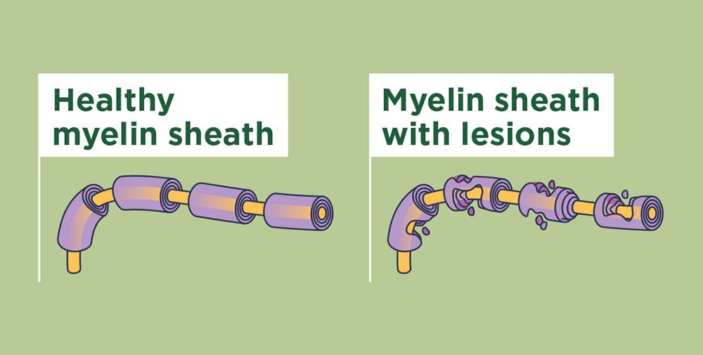 Mikael Simons: Myelin Regeneration | National MS Society