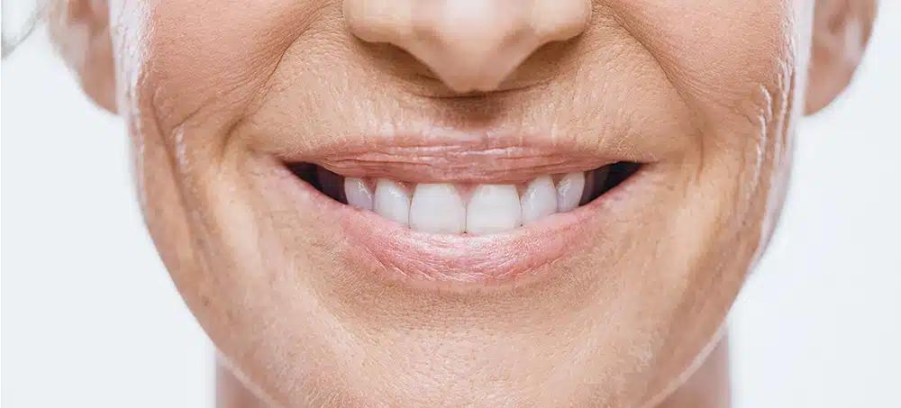 Tips for Taking Care of Your Teeth | National MS Society