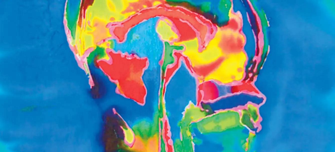 Beautiful Brain | National MS Society