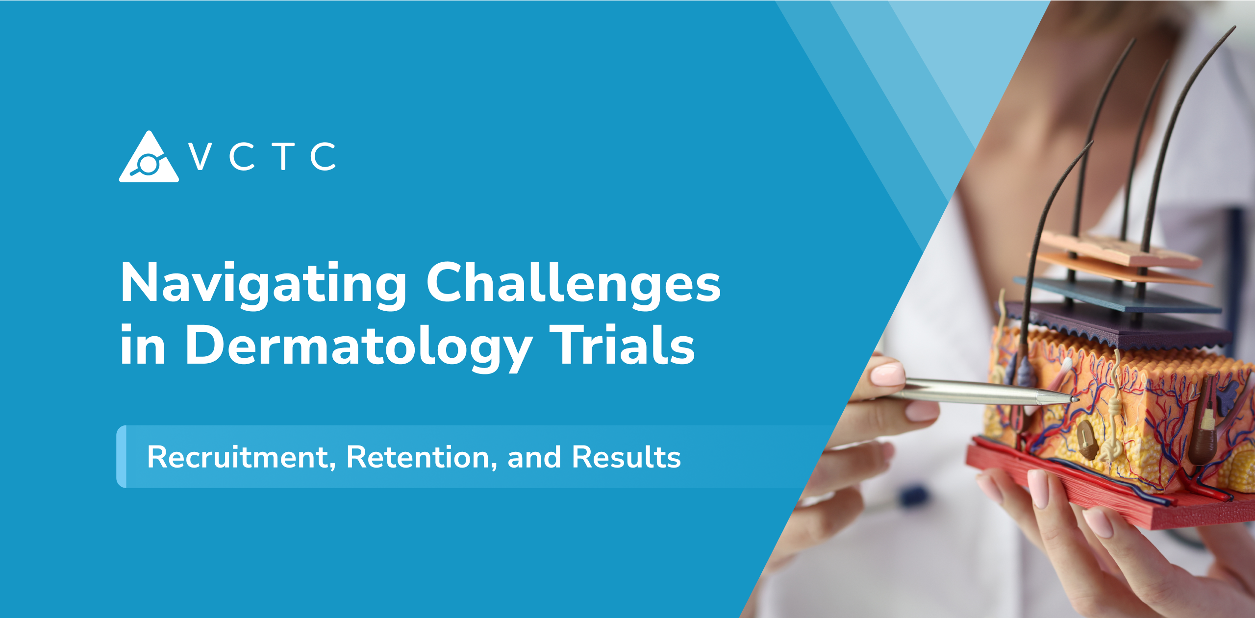 Navigating Challenges in Dermatology Clinical Trials: Recruitment ...