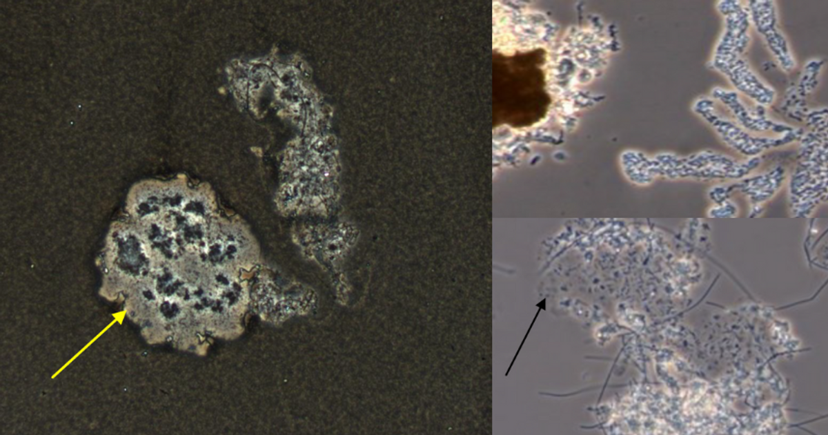 The Relation Between EPS and Viscous Bulking | EnviroZyme