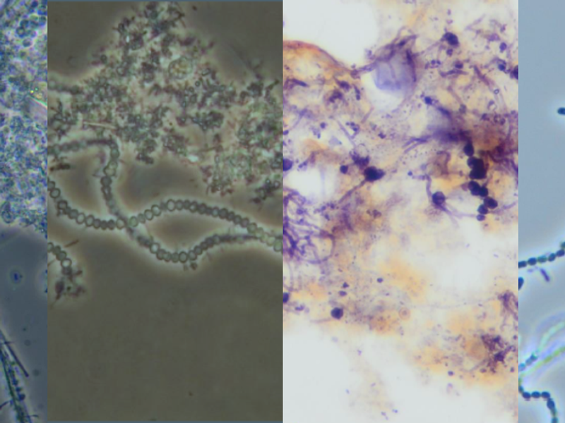 Understanding the Impact of Filaments in Wastewater Treatment Plants ...