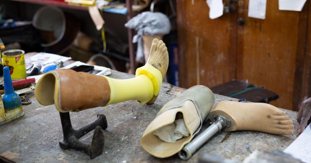 The tech behind Mite | Mite: Charity in Action