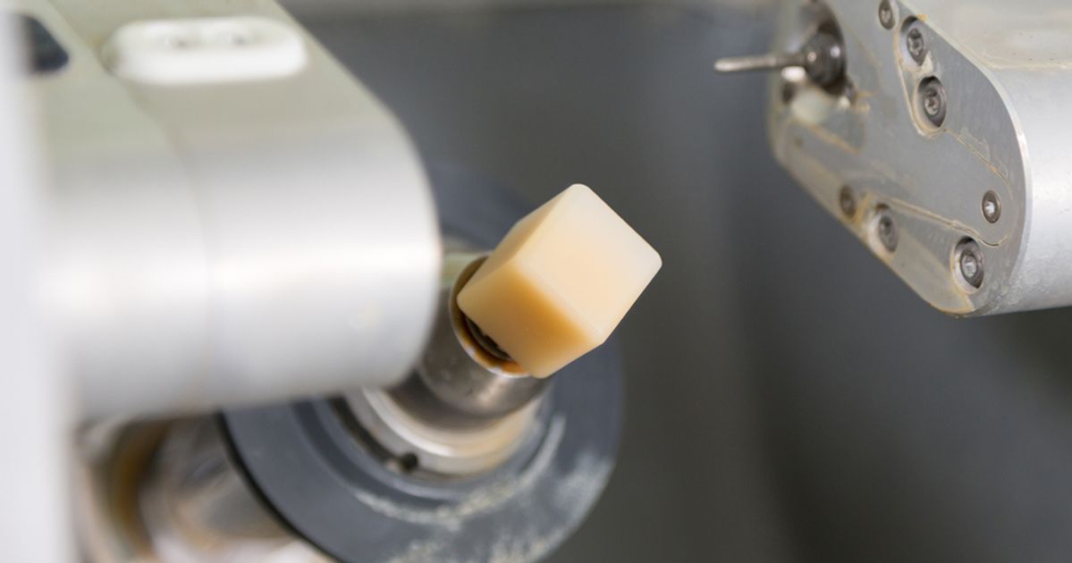 CEREC: CAD/CAM Dentistry - National Dental Care