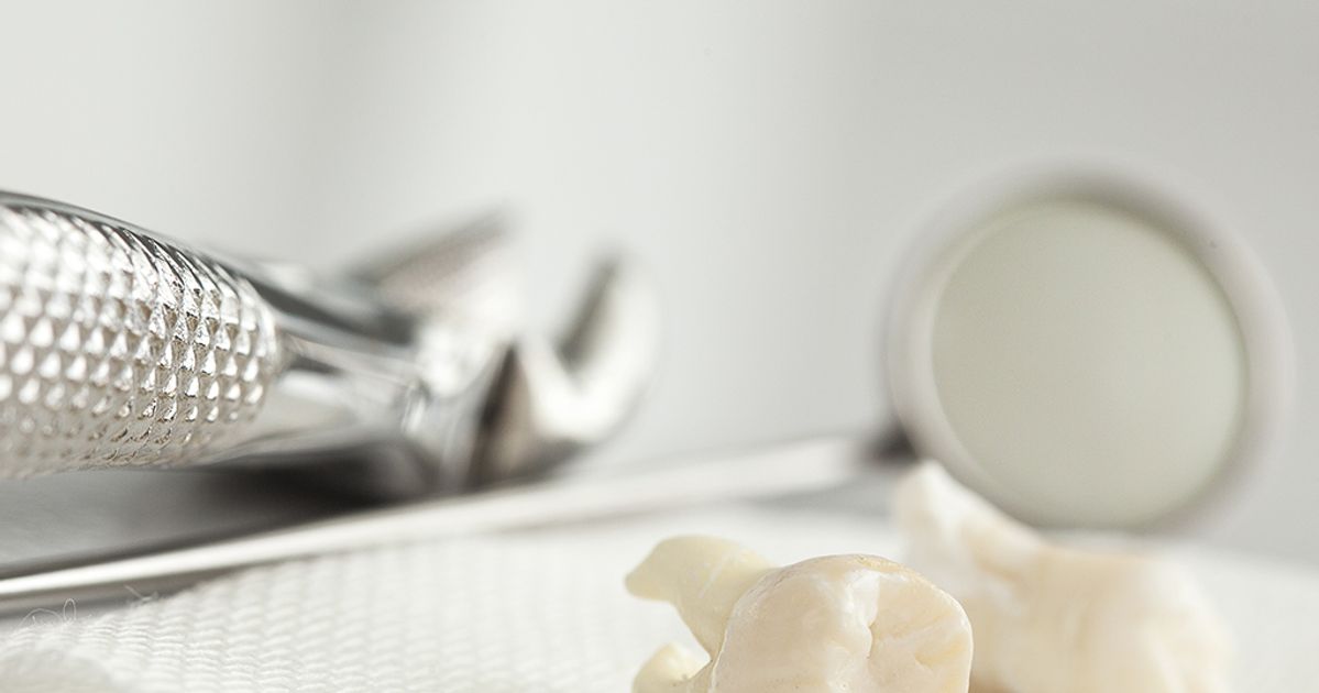 Tooth Extraction Preparation & Support - 818 Dental