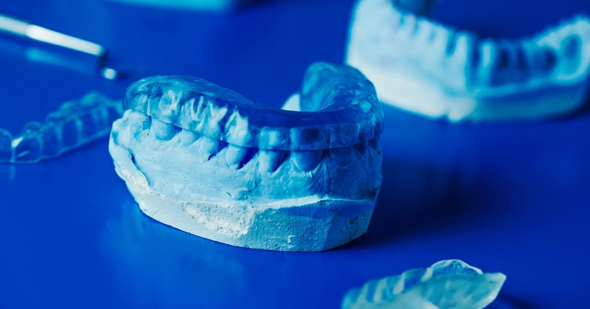 Occlusal Splint - Kissing Point Road Dental