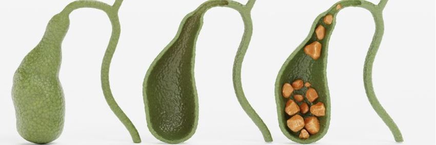 galstenen - Medicijnen.nl