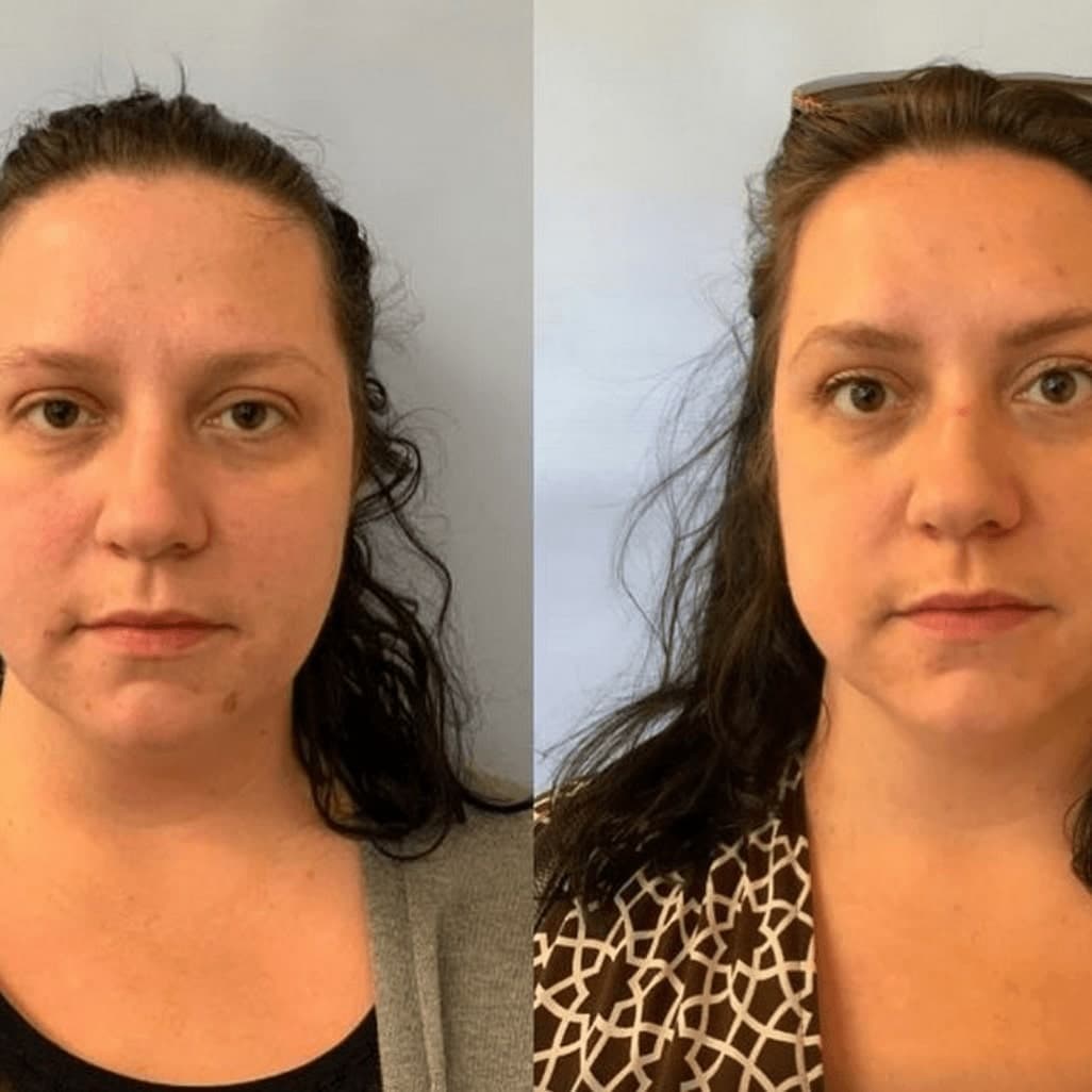 Allure Medical | Vein Treatment, Cosmetics and More