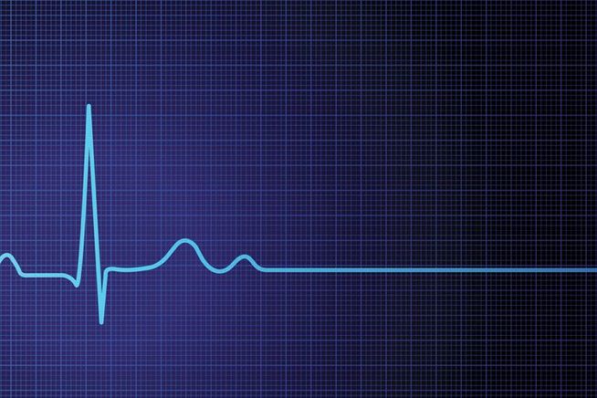 How To Tell If A Person Is Actually Dead | Everplans